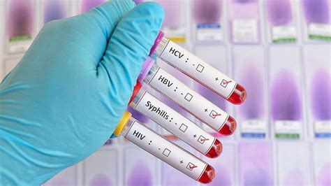 Sexual Health Online Sti Testing Rolled Out In Wales Bbc News