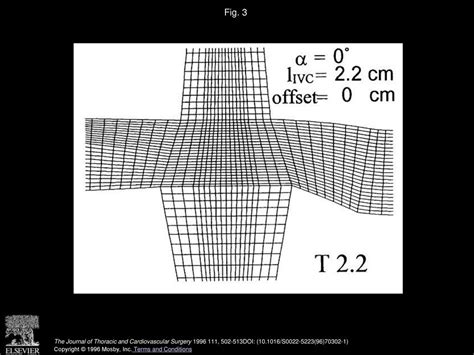 Use Of Computational Fluid Dynamics In The Design Of Surgical Procedures Application To The