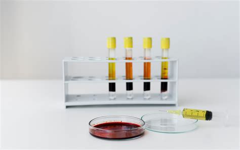 Top 7 Trends In Oral Fluid Drug Test System Market Analysis And Insights