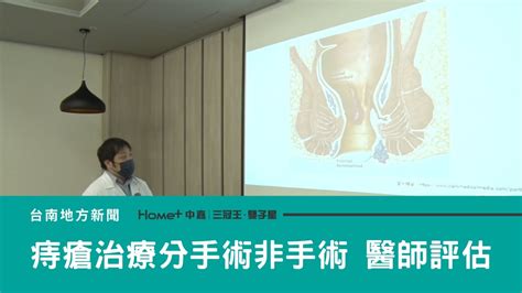 健康醫療｜痔瘡治療分手術非手術 須經專業醫師評估 Youtube