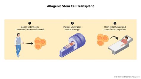 Allogeneic Stem Cell Transplant Tandt