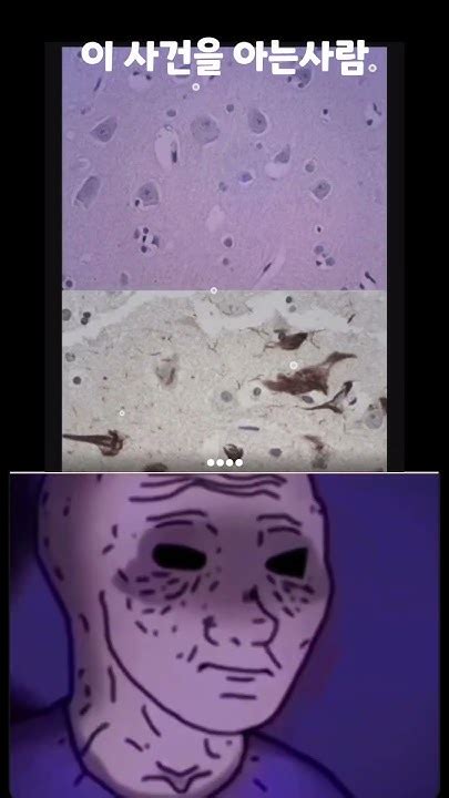 크리스 벤와 살인 및 ㅈㅅ사건 Youtube