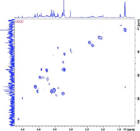 2d 1 H 13 C Hsqc Spectrum Representative Example From An Aga Brain Download Scientific Diagram