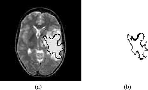 Figure 1 From Cramer Rao Bounds For Parametric Shape Estimation In