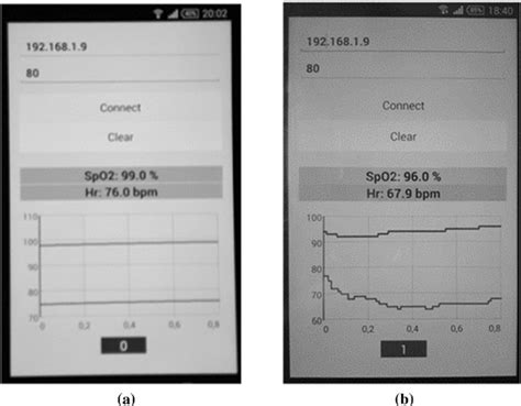 Gui Of The Portable Processing Unit Displaying The Results Of A Test A