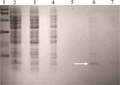 A Sds Page 20 Acrylamide And Tris Tricine Buffer Ni Nta Column