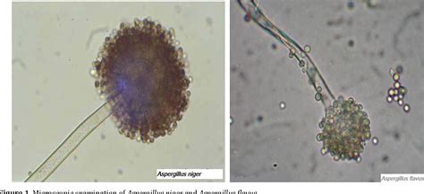 Figure 3 From Fungal Protease Production By Aspergillus Niger And Aspergillus Flavus Using Rice