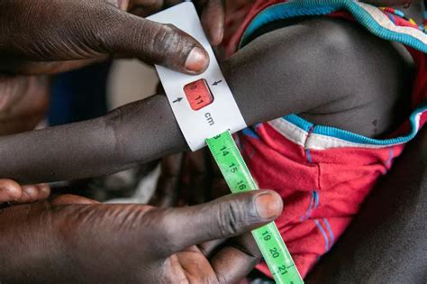 Hunger And Malnutrition Being Driven By Climate Crisis And Conflict In