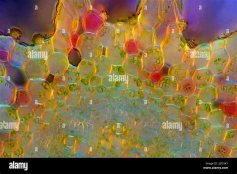 Polarized Light And Dark Field Light Micrograph Of A Transverse Cross