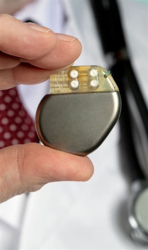 Av Node Ablation At Dr Karthigesan Clinic Chennai