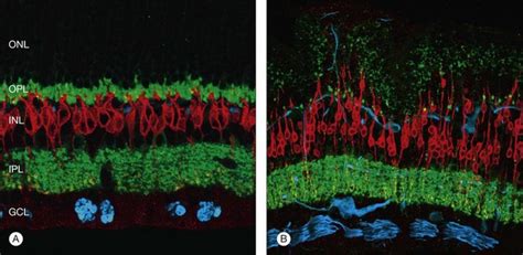 Cellular Effects Of Detachment And Reattachment On The Neural Retina And The Retinal Pigment