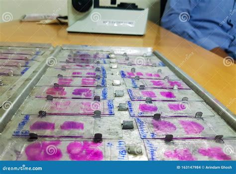 Histopathology Slides Stained With Leishman Stain Displayed And Ready