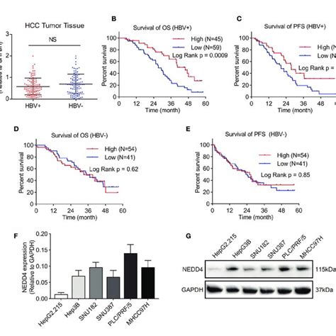 Nedd4 Expression In Hcc Tissues And Cell Lines A Nedd4 Expression