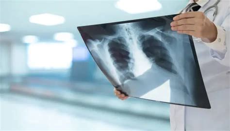X Ray 사진 Unsplash에서 무료 이미지 다운로드