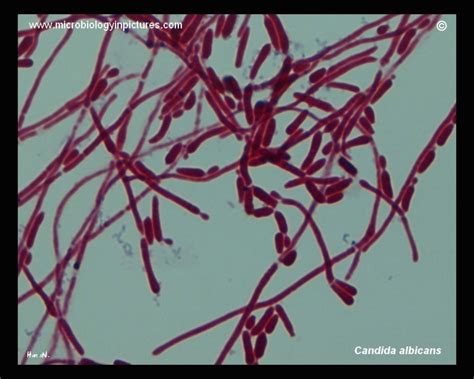Candida Albicans Filamentous Stage Of Development Pseudohyphal And