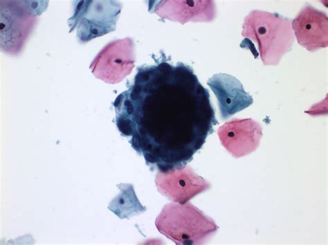 Pathology Outlines Normal And Nonneoplastic Findings