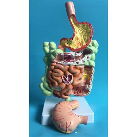 可開發票 人體結腸病理模型 人體消化系統模型 胃解剖 大腸模型直腸十二指腸 內臟構造模型 教學教具模型arge客滿來 蝦皮購物