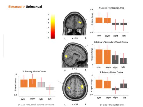 Color Coded Statistical Parametric Maps Showing Clusters With Higher