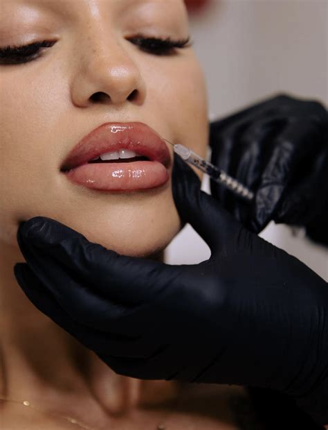 Aesthetics And Laser Wellness Rita Ghosh Md Facp A Comprehensive Guide To Hyperpigmentation Aesthetics And Laser Wellness Rita Ghosh Md Facp A Comprehensive Guide To Hyperpigmentation