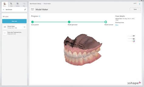 3shape Model Maker Create Dental Models In Minutes Dentistry