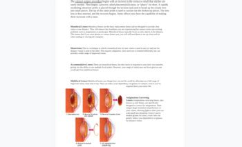 Biology Cataracts Different Types Of Eye Lenses By Resources On Me