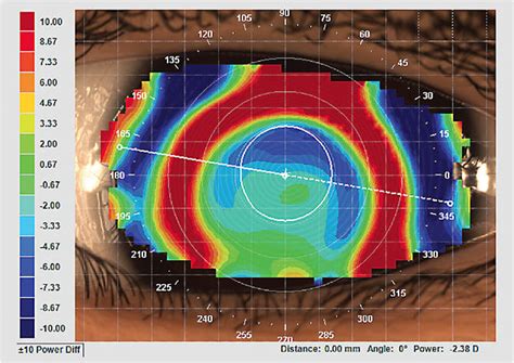 Gp Insights Contact Lens Spectrum