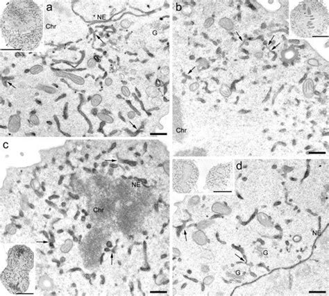 Labeling Of The Er Network With Peroxidase Cytochemistry In Mitotic