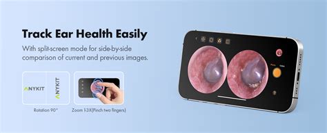 Amazon Anykit Digital Otoscope With Gyroscope HD Ultra Clear View