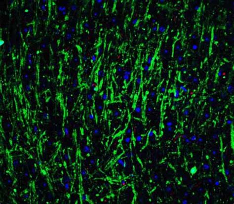 Tet3 Antibody Wb Ihc P If E Buy Now Abcepta