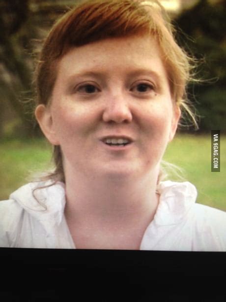 Smallest Lips In The World