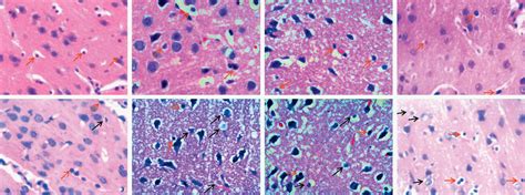 Photomicrographs Of The Outer Granularpyramidal Layer Of The Cerebral