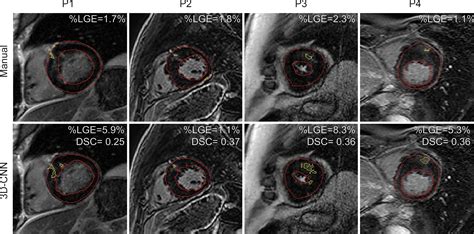 Three Dimensional Deep Convolutional Neural Networks For Automated