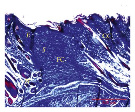 Massons Trichrome Mt Staining Of Granulation Healing Tissue Of