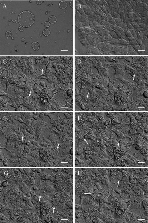 Morphology Of The Blastocystis St 1 Live Parasites Treated Ht 29