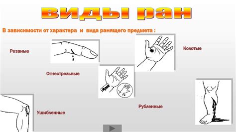 Что такое рана и виды ран Первая доврачебная помощь при ранении