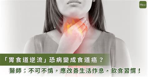 湧酸氣、火燒心竟是身體發出警訊！醫提醒：反覆「胃食道逆流」恐是癌前病變的前奏 Heho健康