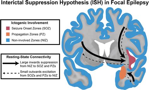 Imaging And Stereotactic Electroencephalography Functional Networks To Guide Epilepsy Surgery