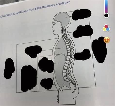 anatomy layering and sectional anatomy flashcards quizlet