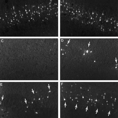 Retrograde Tracing Of Rubro Spinal Neurons After Fluorogold Appli