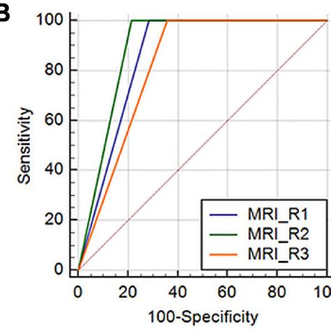 Receiver Operating Characteristics For The Detection Of Prostate Cancer
