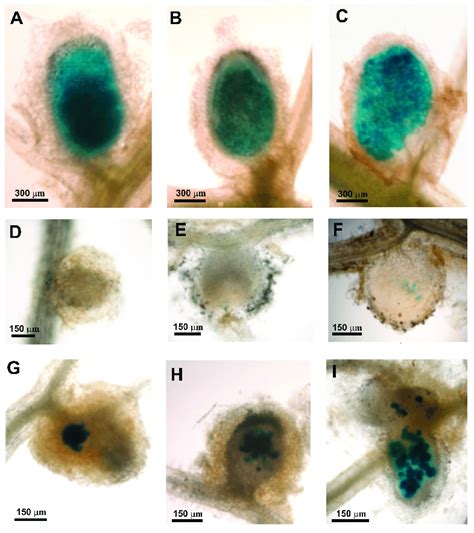 Light Microscopy Of Clover Trifolium Pratense Root Nodules Elicited Download Scientific