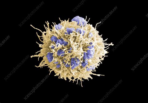 Cervical Cancer Cell Sem Stock Image C Science Photo Library