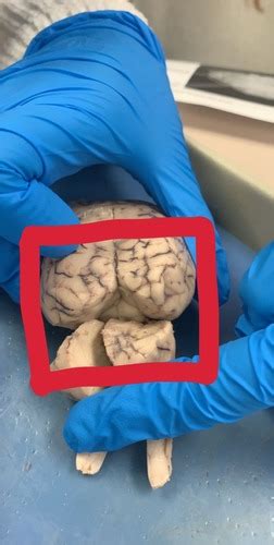Sheep Brain Flashcards Quizlet