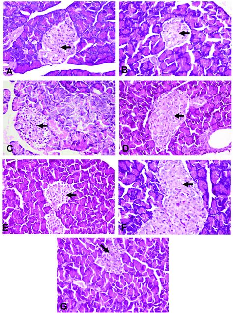 Photomicrographs Of Rats Pancreas Stained With Hande X 400 A Normal