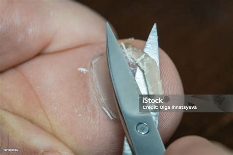 손톱 가위로 발톱을 자르는 남자의 클로즈업 매크로 사진 가위에 대한 스톡 사진 및 기타 이미지 가위 각질제거 개념