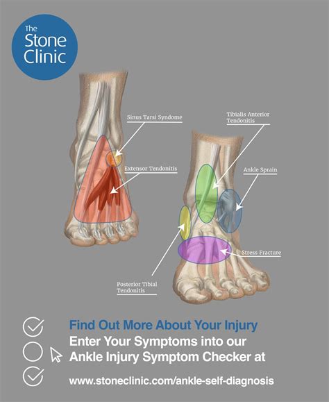Torn Tendon In Ankle Symptoms