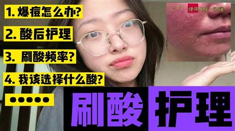 刷酸后如何补水修复？？爆痘闭口粉刺必看！刷酸百科！ Youtube