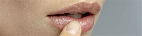 All You Wanted To Know About Lip Cancer The Smile Makeover