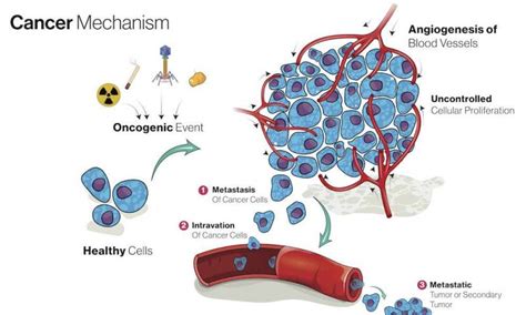 Cancer Metastasis Hijacks Process Healthy Cells Use To Move Around The Body Cancerworld Magazine