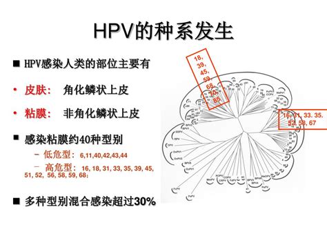 Ppt 人乳头瘤病毒 Hpv Human Papillomavirus 与子宫颈癌 Hpv Infection And Hpv